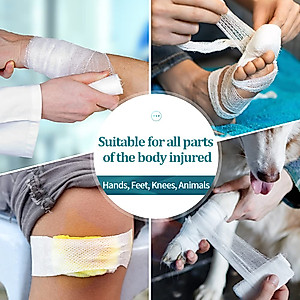 Gauze Rolls White Gauze Bandages for First Aid Wound Care and Medical Supplies Breathable Gauze Packets Latex Free Stretchable 3.1" x 6.5 Yard 12 Rolls