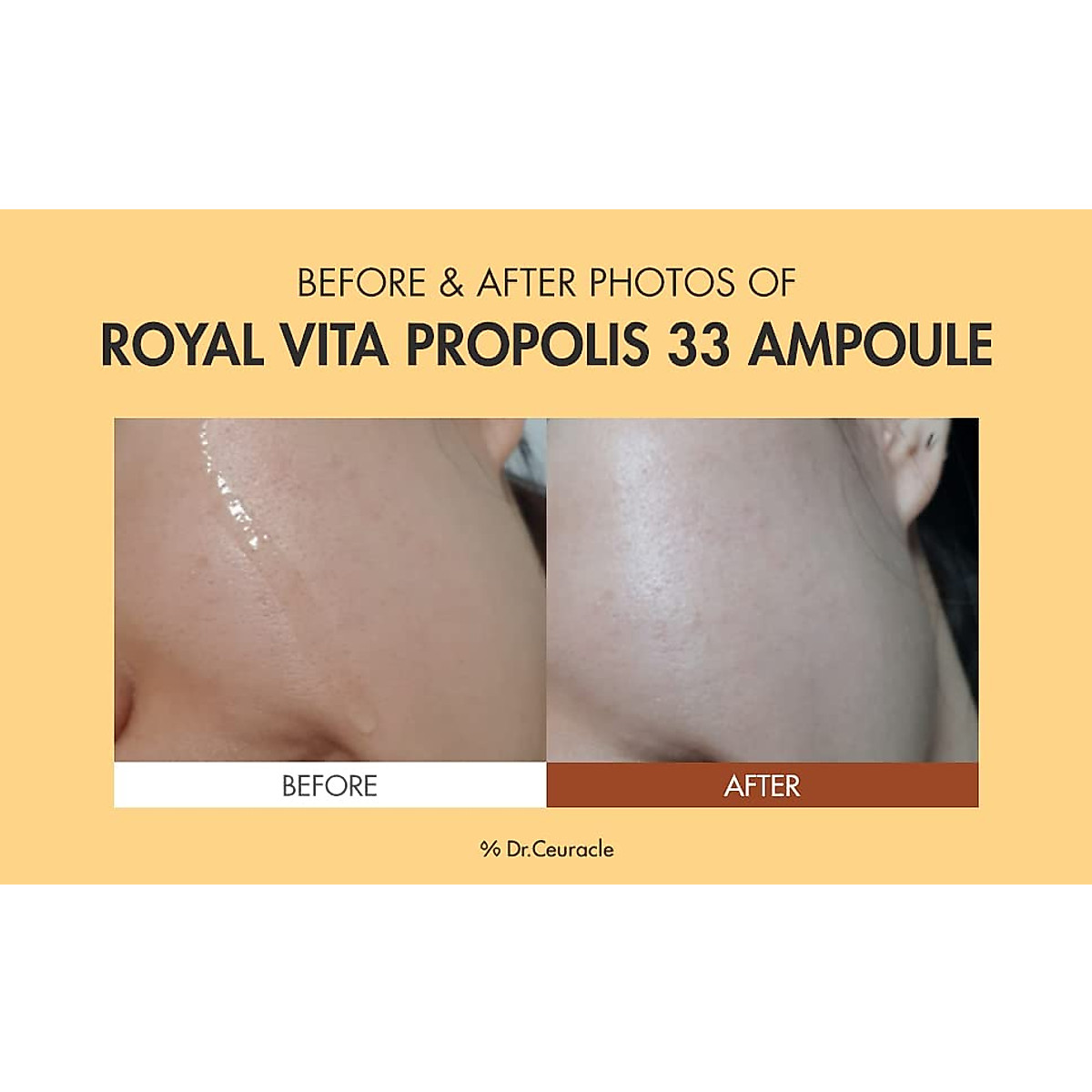 Honey Nourishing EssenceㅣRoyal Vita Propolis 33 AmpouleㅣKorean Skin Care Contains Royal Jelly Extract, PanthenolㅣEffective Vitamin Serum strengthen the skin Moisturizing, SoothingㅣDr.Ceuracle