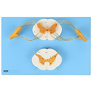 Axis Scientific Enlarged Spinal Cord Model, 8X Life Size Nerves Plus Anterior and Posterior Nerve Roots and Spinal Ganglion - Includes Product Manual, and Base for Display