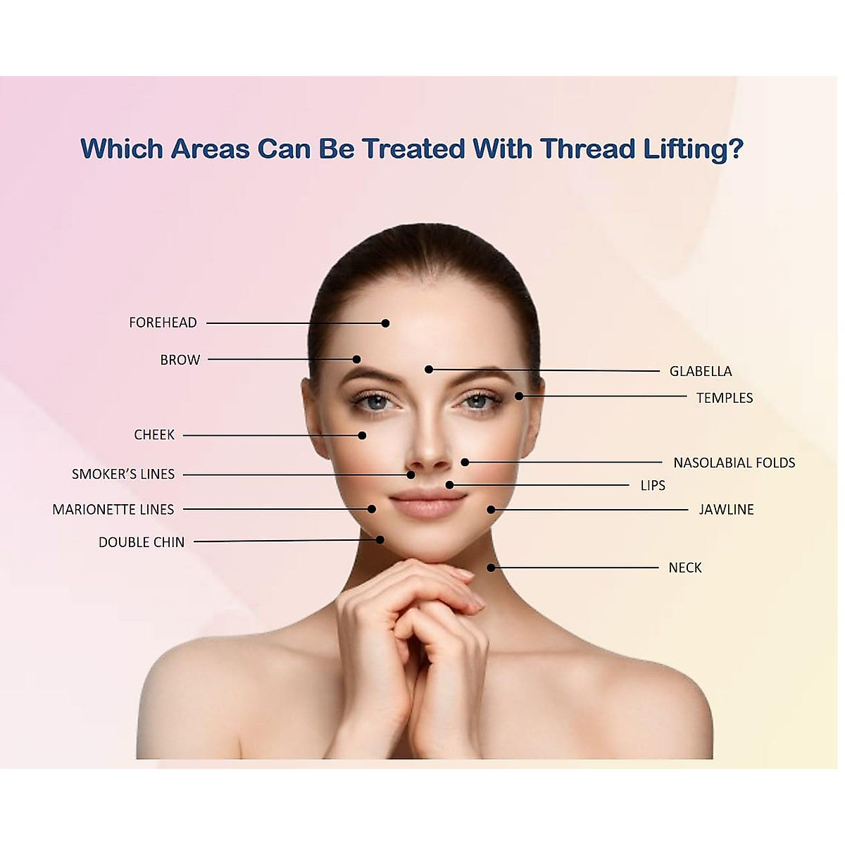 ACE - Multi Thread/L Cannular PDO thread for Forehead/Nose/Nasolabial Folds (23G38/50mm)