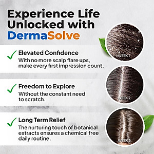 Dermasolve Psoriasis & Dandruff Oil, Dermatologist Approved for Flaky Scalp Relief
