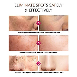 EnaSkin Professional Dark Spot Remover for Face and Body, Perfecting Dark Spot Corrector Serum Treatment, Melasma, Freckle, Sun Spot, Hyperpigmentation, Blemish, Brown Spots for Men&Women(1.0 Fl Oz)