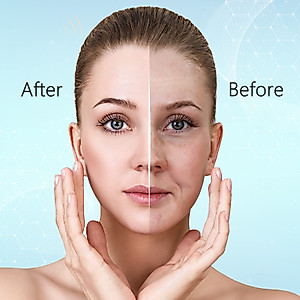 YourMate Handheld Phototherapy Device High Frequency Wand/Machine with Neon Tubes for Face Chin Neck Hair, Facial Skin Wand Machine with 4 Different Tube