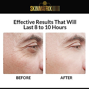 Puffy Eyes Treatment Serum- Anti Aging Under Eye Cream Formula for Puffiness, Dark Circles, Fine Lines, Wrinkles & Under Eye Bags with Hyaluronic Acid & Vitamin C. Instant Results within Minutes.