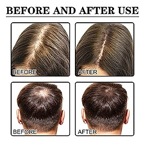 Allurium Hair Growth Serum for Black Women, Anti Hair Loss Nourish Dry Damaged Hair Repair, New Allurium Hair Growth Serum, Fast Natural Hair Growt, Allurium Beauty Hair Serum for Black Women (1PC)