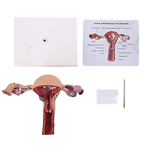 Uterus and Ovary Model, Human Anatomical Model Pathological Female Reproductive Organ Model for School Teaching Demonstration, Educational Tool