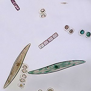 Freshwater and Marine Diatoms Slide, w.m.