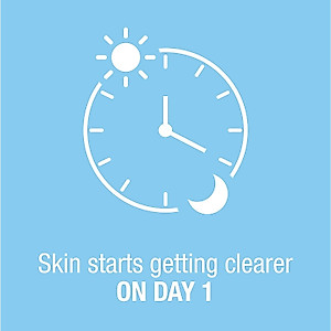 Neutrogena On-The-Spot Acne Spot Treatment with 2.5% Benzoyl Peroxide Acne Treatment Medicine to Treat Face Acne, Gentle Benzoyl Peroxide Pimple Gel for Acne Prone Skin,.75 oz (Pack of 2)