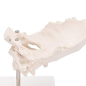 3B Scientific A71/5 Atlas and Axis w/ Occipital Plate on stand - 3B Smart Anatomy