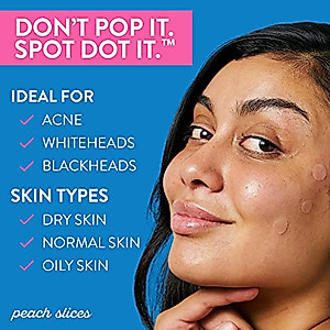 Peach Slices | Acne Spot Dots | Hydrocolloid Acne Patches | For Zits, Blemishes, & Breakouts | Vegan | Cruelty-Free | Pimple Patches | Facial Skin Care Products | 3 Sizes (7mm, 10mm, & 12mm) | 30 Ct