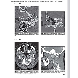 Head and Neck Imaging: Case Review Series