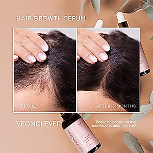 Vegnclever Hair Growth Serum - 100% Vegan Intensive Hair Gro Serum - Natural Hair Loss and Regrowth Treatment for Women & Men, Hair Thickening Products for Fuller-looking, Thicker and Healthier Hair, 50ML