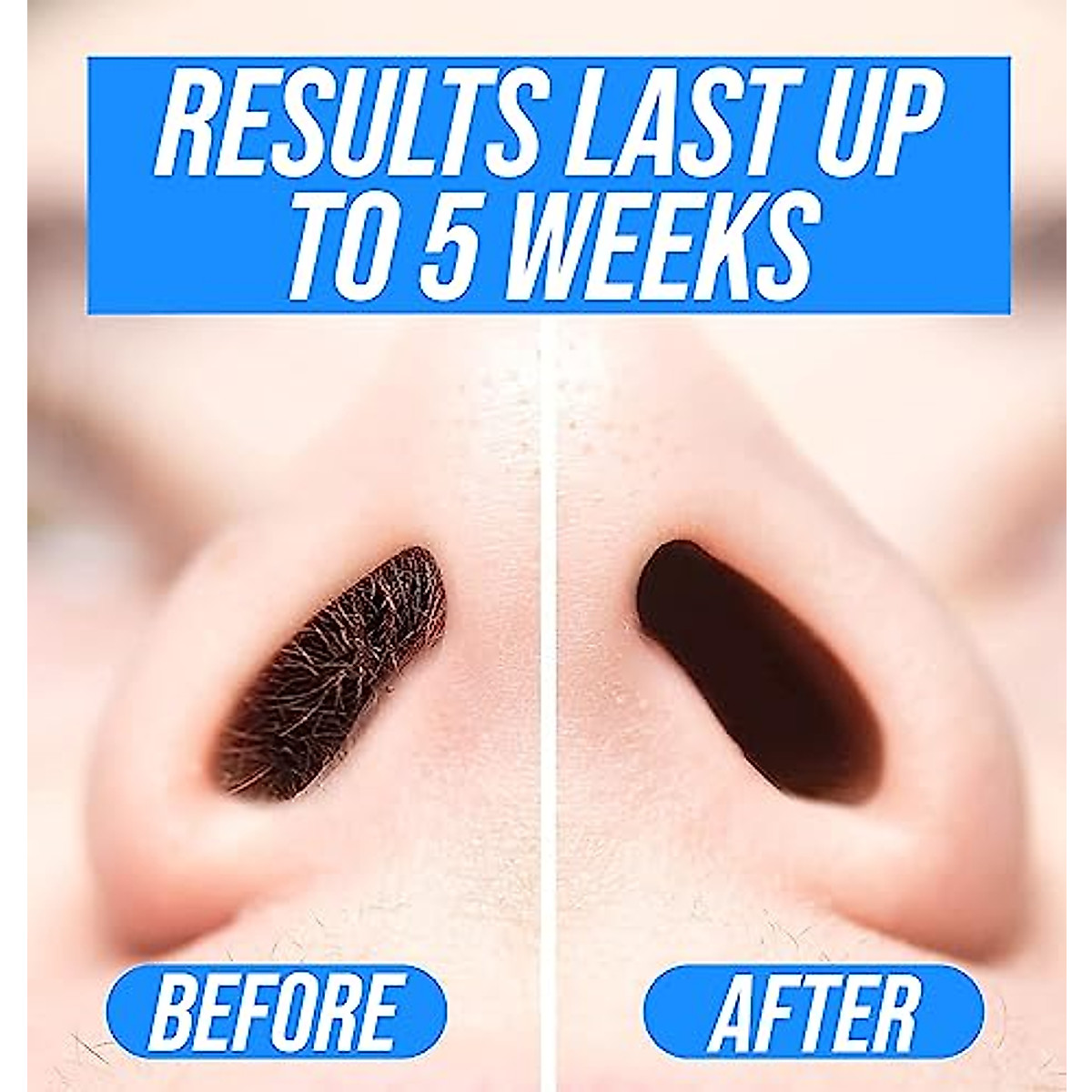 Kenashii Super Nose Wax Kit | 100 g Wax, 24 Applicators | No Microwave Required | New Nose and Ear Hair Removal Kit | Nasal Waxing For Men and Women | 12 X Balm Wipes and Mustache Guards | Storage Bag