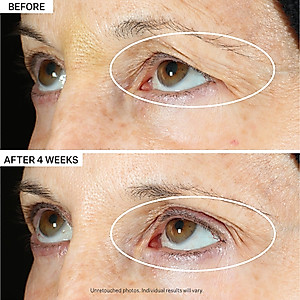 StriVectin Tighten and Lift Peptight 360 Degree Eye Serum with Tightening and Brightening Peptides for Wrinkles, Under Eye Bags and Puffiness, 1 fl. Oz