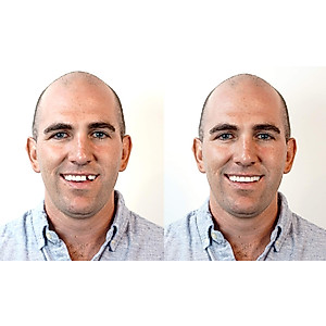 Instant Smile Triple Shade Temporary Tooth Kit - Replace A Missing Tooth in Just 5 Minutes!