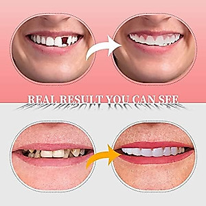 Fake Teeth Kit, 4 PCS Dentures Teeth for Women and Men, Dental Veneers for Temporary Teeth Restoration, Nature and Comfortable, Protect Your Teeth and Regain Confident Smile