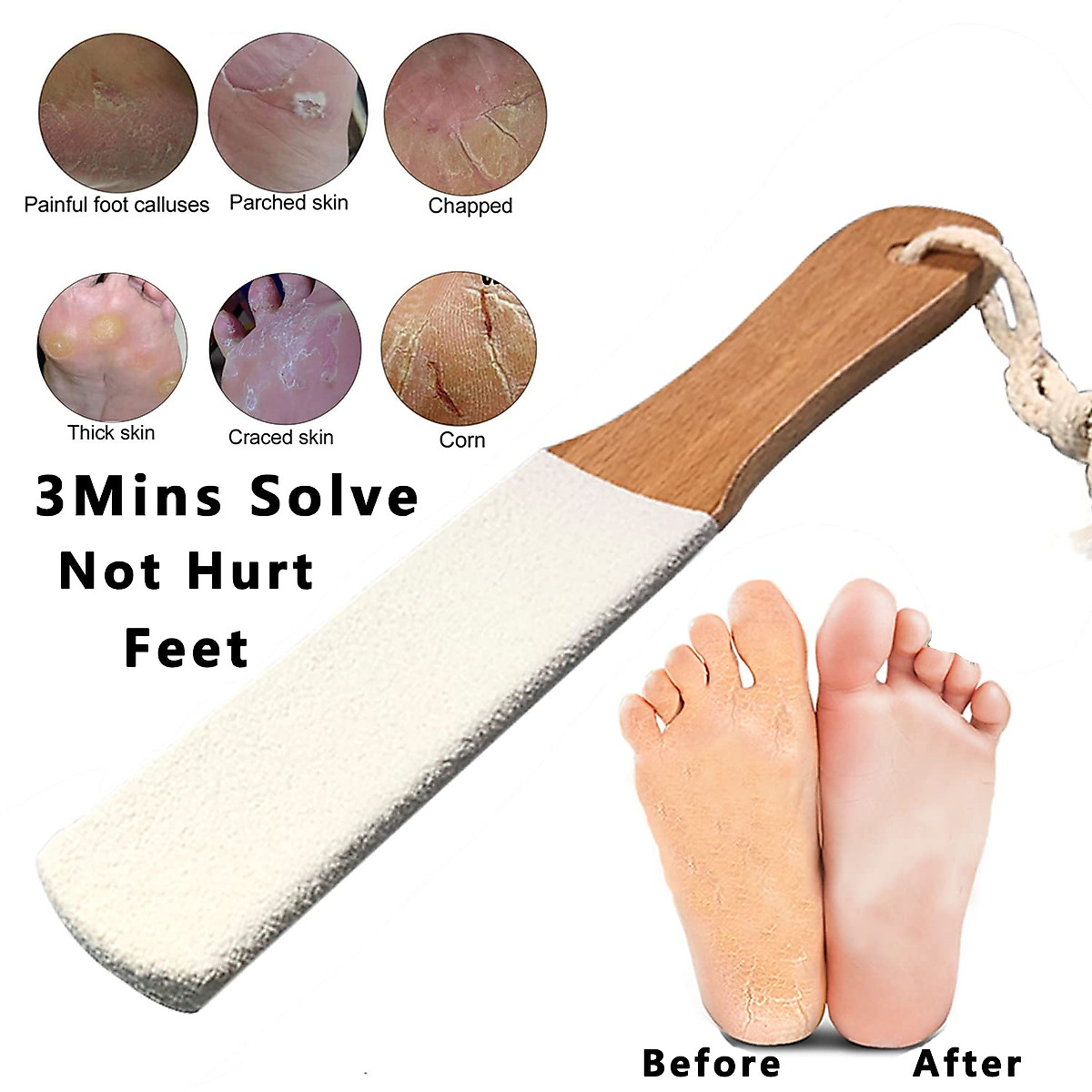 Kinepi Feet Callus Removers Professional Colossal Foot Scrubber Pedicure Foot File Foot Massager Pumice Stone for Feet,Remover Corn Hard Skin Dead Skin Exfoliator for Use in Shower Feet Care Tools