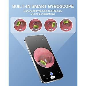 ScopeAround Wireless Otoscope with Light Ear Camera, 3.9mm Ear Wax Removal Tool Camera, 720P HD with 6 LED Lights, WiFi Wireless Otoscope Camera, Ear Scope Compatible with Android and iPhone