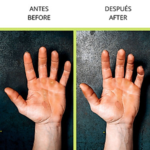 Velites Callus Remover for Hands and Feet. Eliminate Dead Skin for Crosstraining, Gymnastics, Climbing or Running Stone