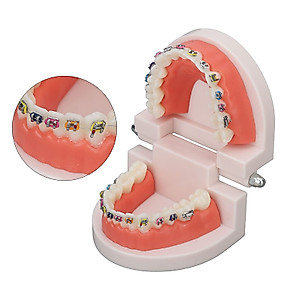 Typodonts Orthodontics Demonstration Model, Dental Orthodontic Model with Metal Wires and Bracket Teaching for Adults and Children Learning