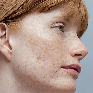 Obagi Nu-Derm Toner – Alcohol-Free, Balancing Nondrying Toner with Witch Hazel & Aloe Vera, Safe for Sensitive Skin – 6.7 oz