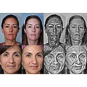 dEpPatch DARK SPOT Correcting Cream with ANTI AGING Peptides for Face and Body | Tighten, Maintain Even Radiant Skin Tone| All Natural Active Ingredients, Made in the USA (1 fl oz)