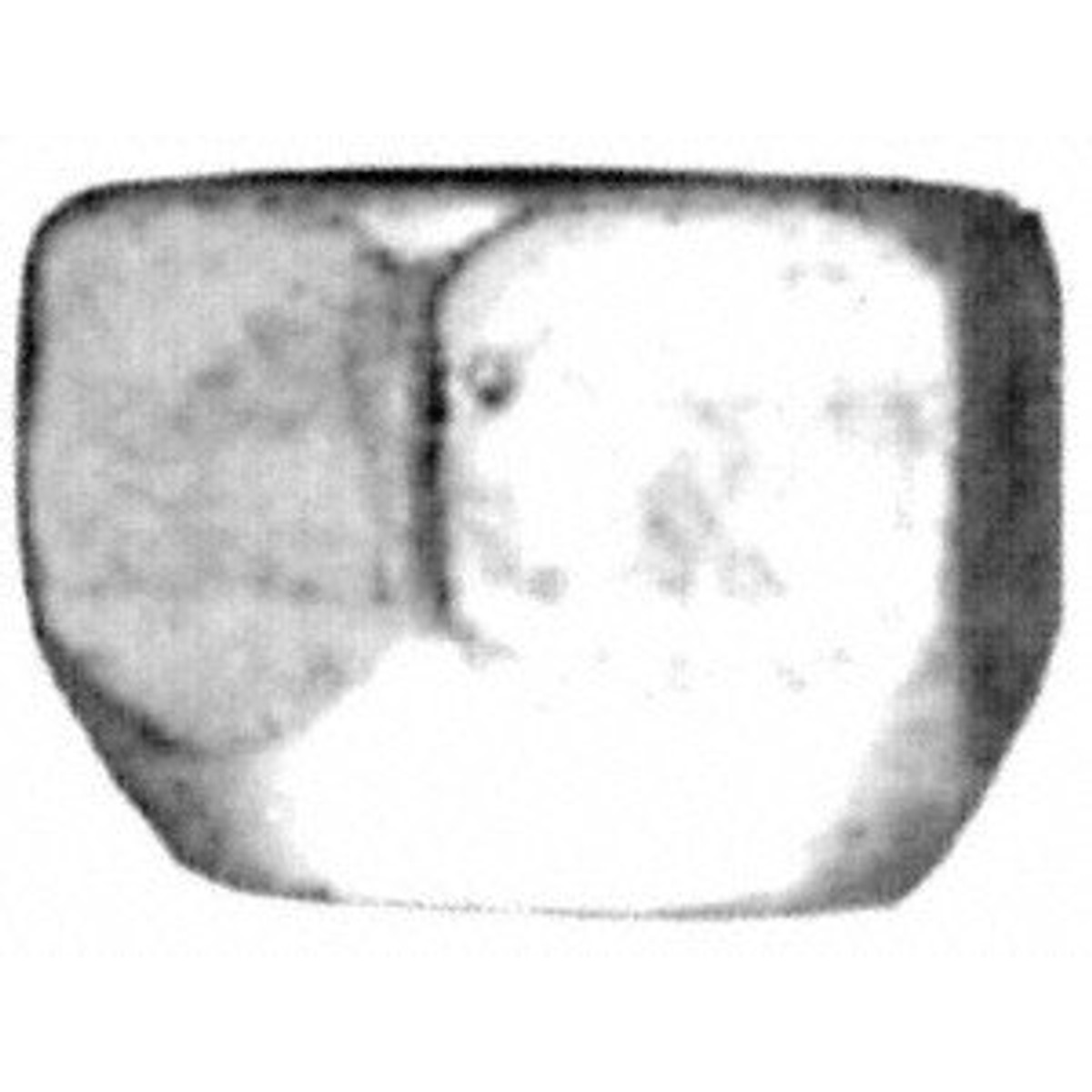 Dorman 611-062 Wheel Nut,M12-1.5