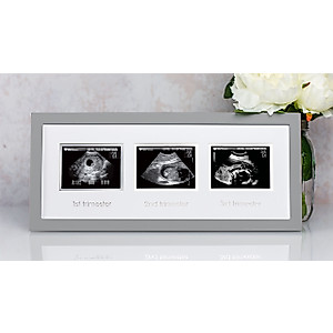 Pearhead Triple Sonogram Picture Frame, Pregnancy Keepsake Photo Frame, Gender-Neutral Baby Nursery Décor, Baby Accessory for New and Expecting Parents, Gray