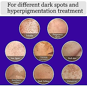 Inlifay Dark Spot Remover for Face Hyperpigmentation Treatment. Dark Spots, Melasma, Freckle, Sun Spots Removal Dark Spot Corrector Cream for Women and Men