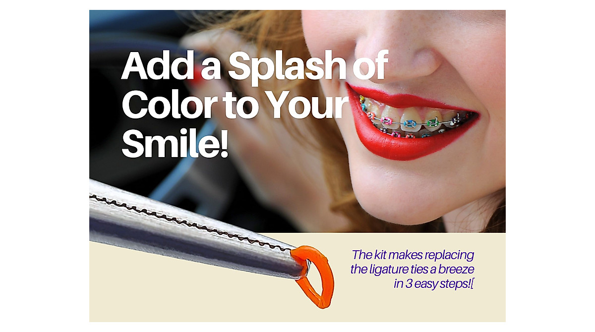Dental Braces Color Changing Kit - DIY Color Ties