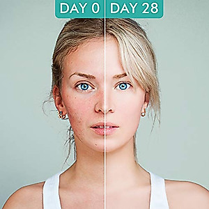 Mabox Moisturizer Cream for Face and Eye Area with 2.5% Active Retinol, Hyaluronic Acid, Vitamin E, Anti Aging Formula Reduces Wrinkles, Fine Lines, Best Day and Night Cream (1.7 Fl. Oz)