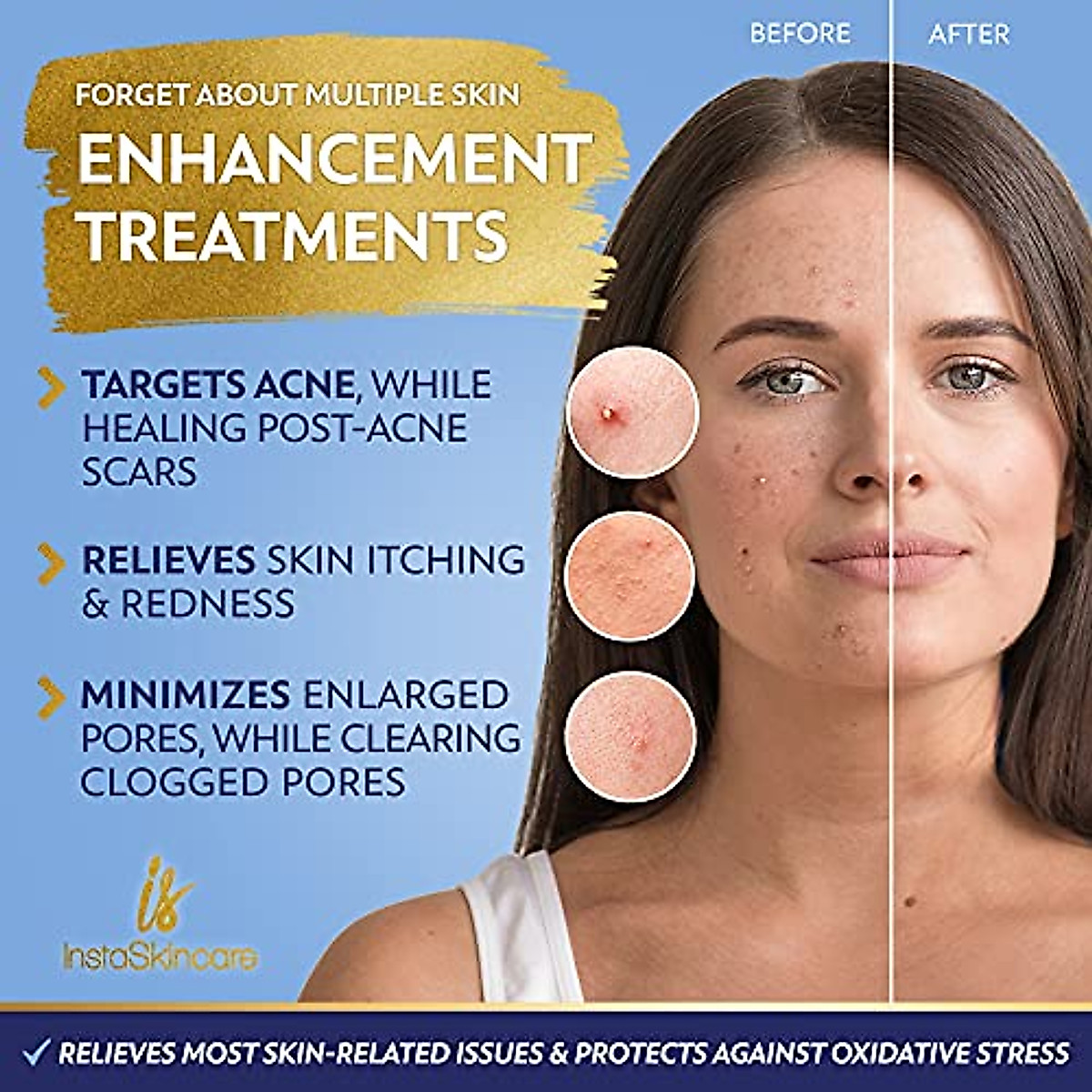 DOUBLE SIZED (2Oz) Niacinamide Serum for Face 10% with Zinc 1% Vitamin B3 Facial Serum Brightening Serum for Acne Pore Minimizer and Dark Spot Remover