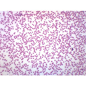 EISCO 10pk Frog Blood Smear, Prepared Microscope Slides - 75 x 25mm - Classroom Pack, 10 Slides in Storage Case - Biology & Microscopy