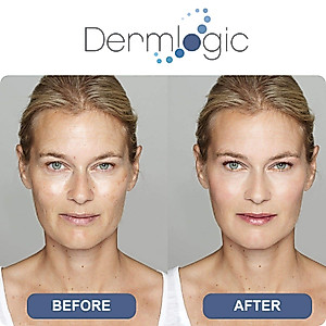 Dark Spot Corrector Cream- Visibly Fades & Repairs Marks from Dark Spots, Sunspots, Age Spots, Acne Scars, Brown Spots & Freckles for Face & Body. Safe for All Skin Types. 