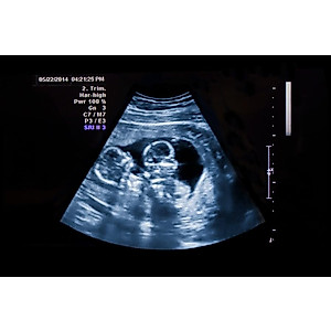 The Grandparent Gift Co. Grandma of Twins Poem White Double Hinged 4 x 6 Photo Frame with Ribbon