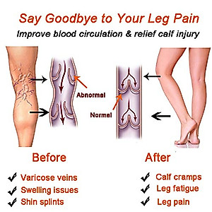 Halsy Women's Footless Compression Socks (20-30mmHg) 2 Pairs Medical Calf Compression Sleeve for Swelling, Shin Splint, Varicose Veins, Edema, Nurses & Maternity