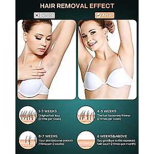 OUBABO IPL Hair Removal for Women and Man, Laser Hair Removal Device with Ice Cooling Care, at-Home Permanent Hair Reduction for Facial Armpits Legs Bikini Line Whole Body, Come with Razor and Goggles