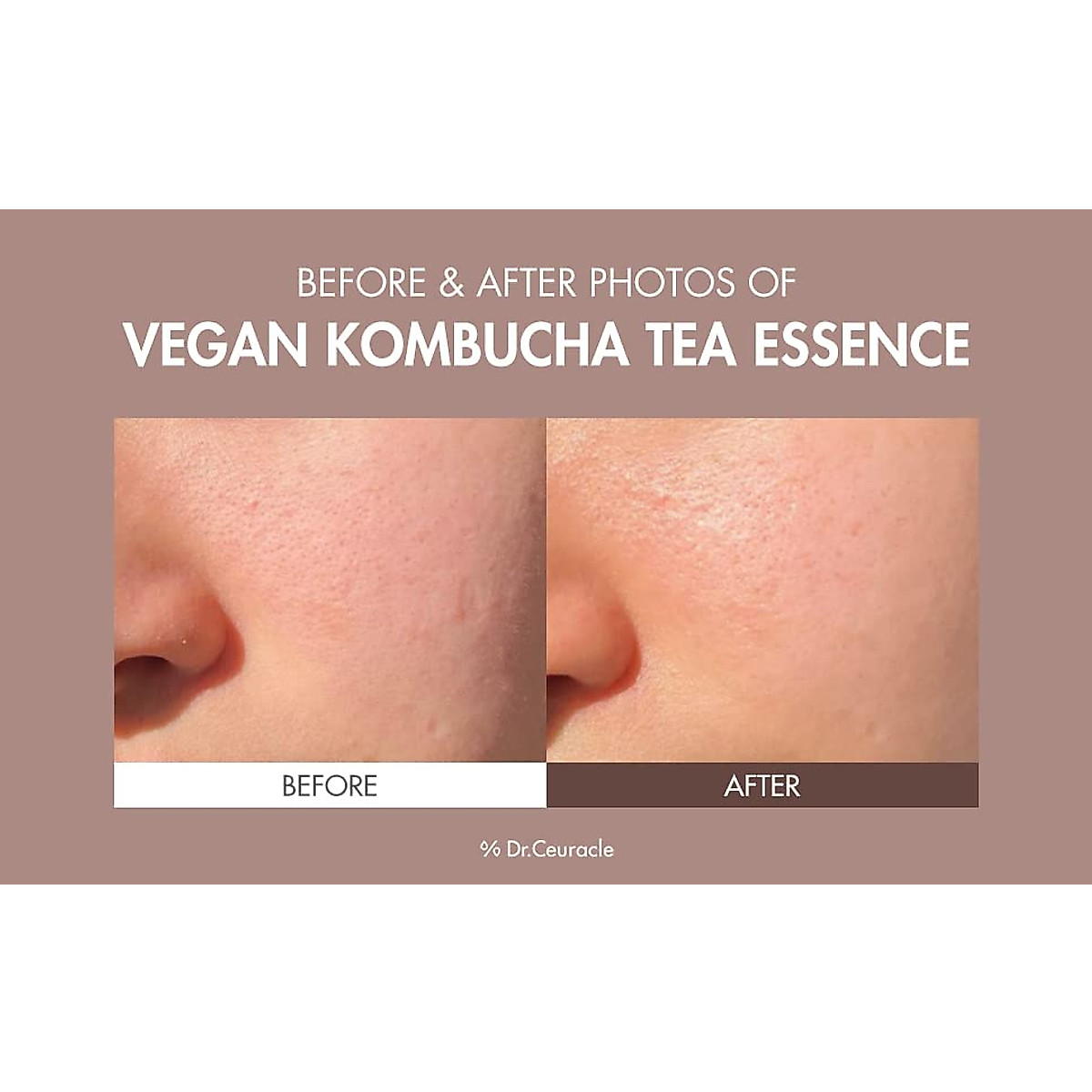 Dr.Ceuracle by leegeehaam Vegan Kombucha Cream Essence (150 ml / 5.07 fl. oz.) - All-in-One Hydrating Serum formulated Kombucha Tea Extract, Paraben Free, Cruelty-Free Korean Skincare