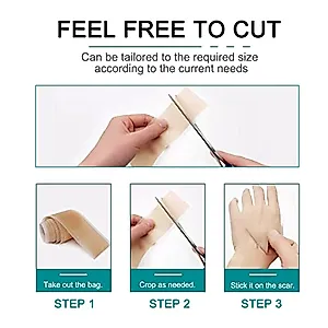 Silicone Scar Sheets (1.6” x 120” Roll-3M), Silicone Scar Tape Roll, Scar Silicone Strips, Reusable, Professional Scar Removal Sheets for C-Section, Surgery, Burn, Keloid, Acne et