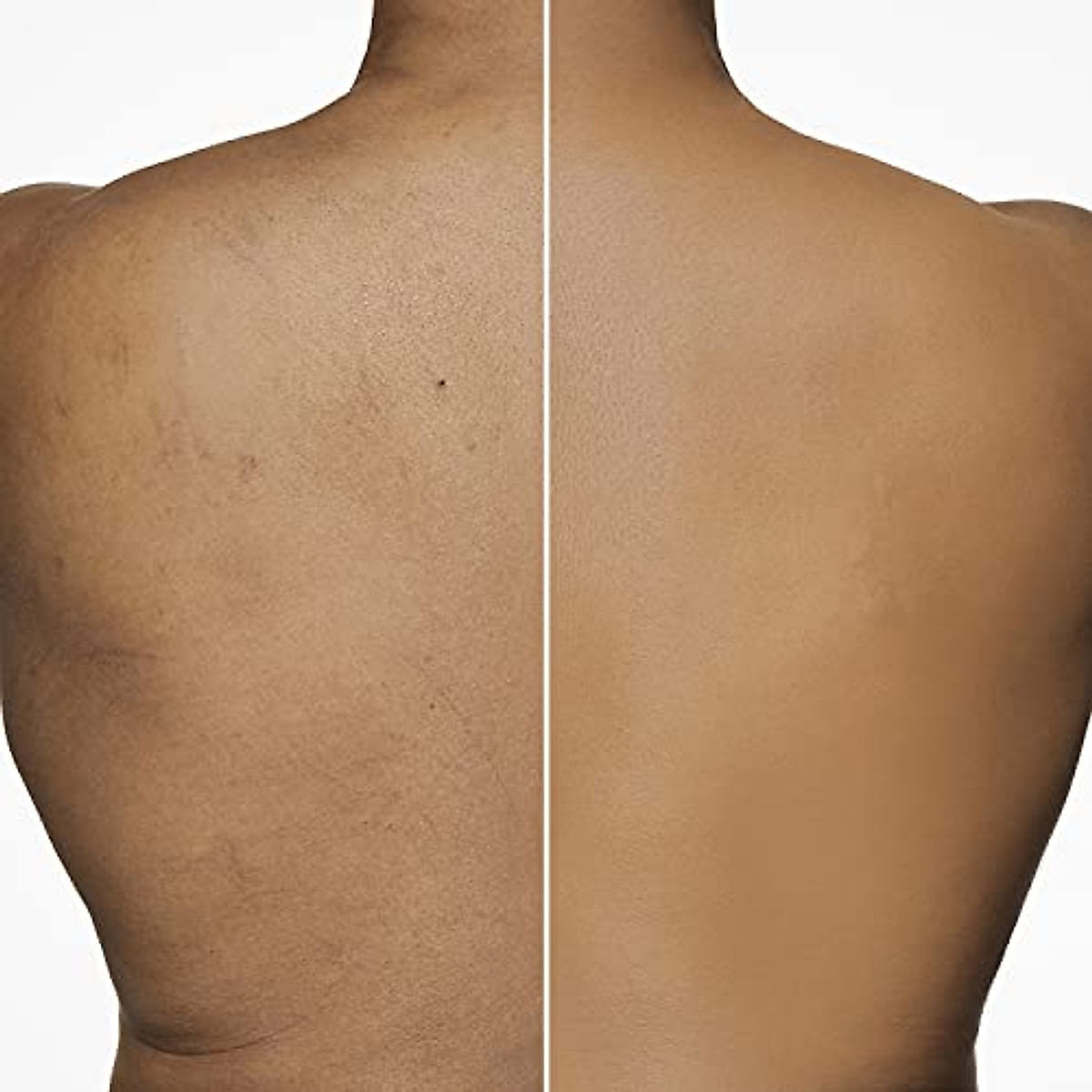 Dermablend Leg and Body Makeup Foundation