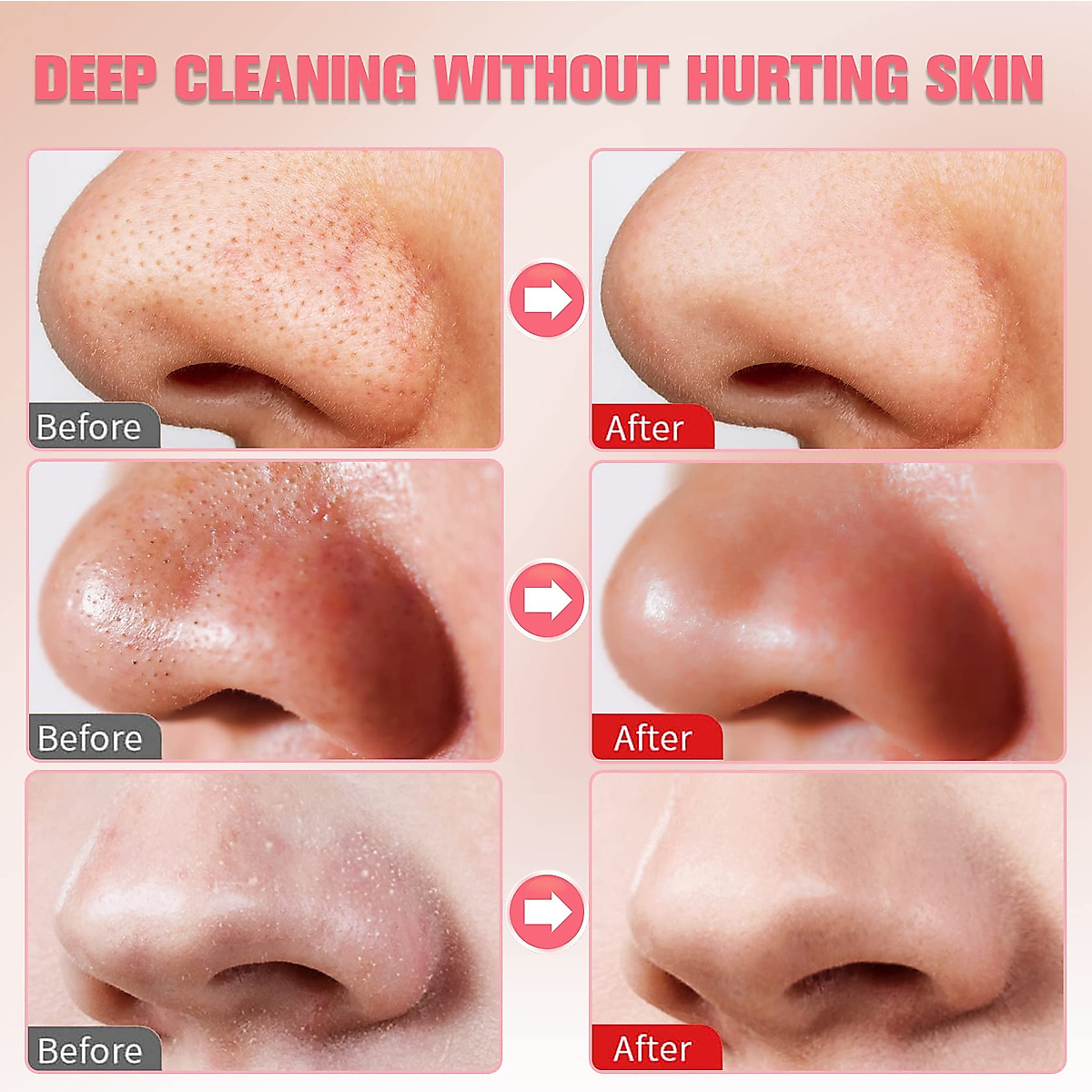 Blackhead Remover Pore Vacuum - LED Screen & USB Rechargeable Facial Pore Cleaner, Comedone Extractor Tool,Acne Extractor Tool with 3 Suction Power,4 Probes Black Head Remover for Face for Women & Men