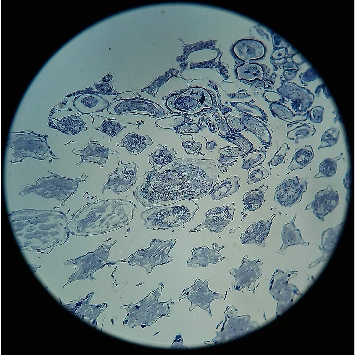 Prepared Animal Plant Cell Mitosis Meiosis Amitosis Comparison Microscope Slides Set, 5pcs Specimens to Display with Students in Biology Class (Mitosis & Meiosis)