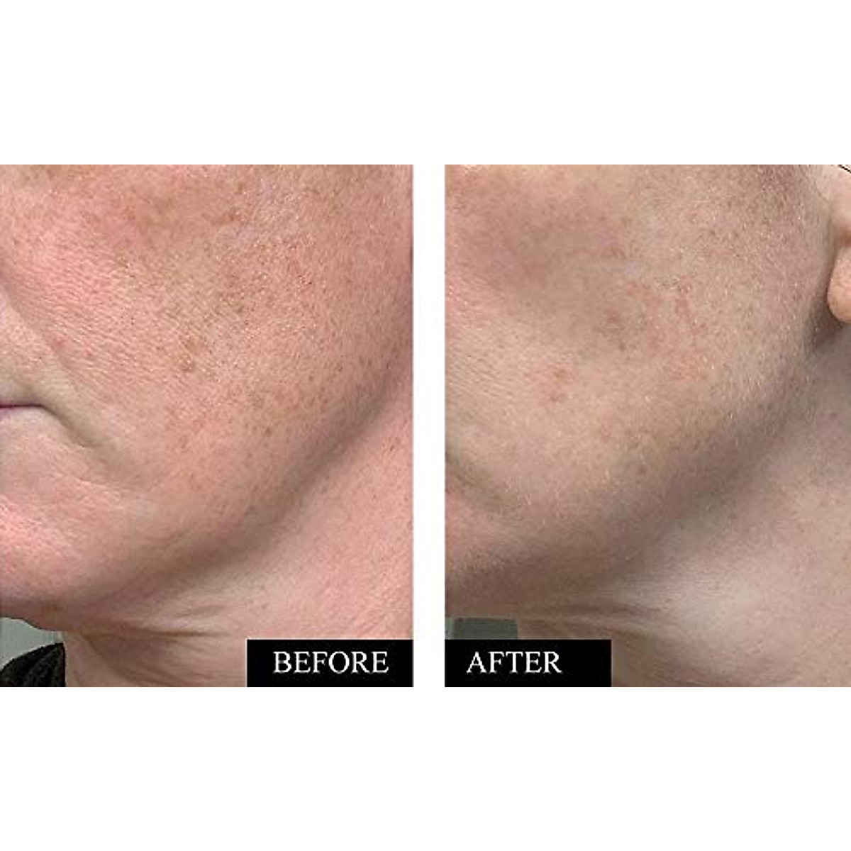 Organic Vitamin C Serum for Face with Hyaluronic Acid - Best Anti Wrinkle Facial Serum to Reduce Wrinkles, Dark Spots & Sun Damage - Anti Aging Brightening Vitamin C Face Serum for Women & Men -1.7 Oz