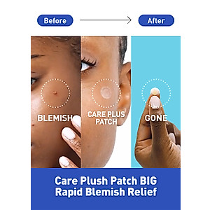 OLIVE YOUNG Care Plus Spot Patch 1 Pack | Hydrocolloid Acne Korean Spot Patch to Cover Zits, Pimples and Blemishes, for Troubled Skin and Face (102 Count - 10mm*72ea + 12mm*30ea)