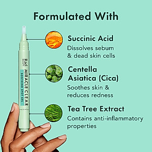 Rael Acne Spot Treatment, Miracle Clear Soothing Spot Gel Pen - Acne Gel, Pimple and Blemish Treatment, Korean Skincare, for Early Stage, Succinic Acid, Tea Tree, Cica, Vegan, Cruelty Free (0.14 oz)