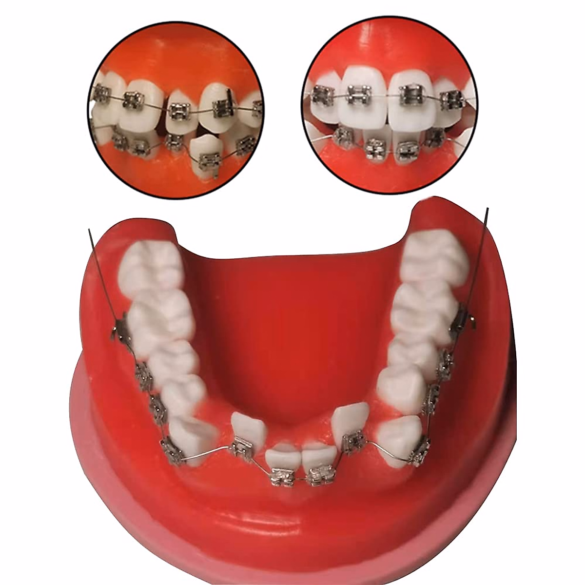 TEPTOARCH Orthodontic Practice Model Teeth Model for Training Studying Teaching Dentist Ortho Bracket Treatment Typodont Jaw Model