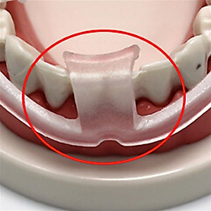 Ellylian Bite Guard for Teeth Clenching Nighttime Mouth Guard Kids Sleep Teeth Guards for Upper and Lower Jaw Night Grinding Teeth Guard Comfortable Transparent Dental Guards