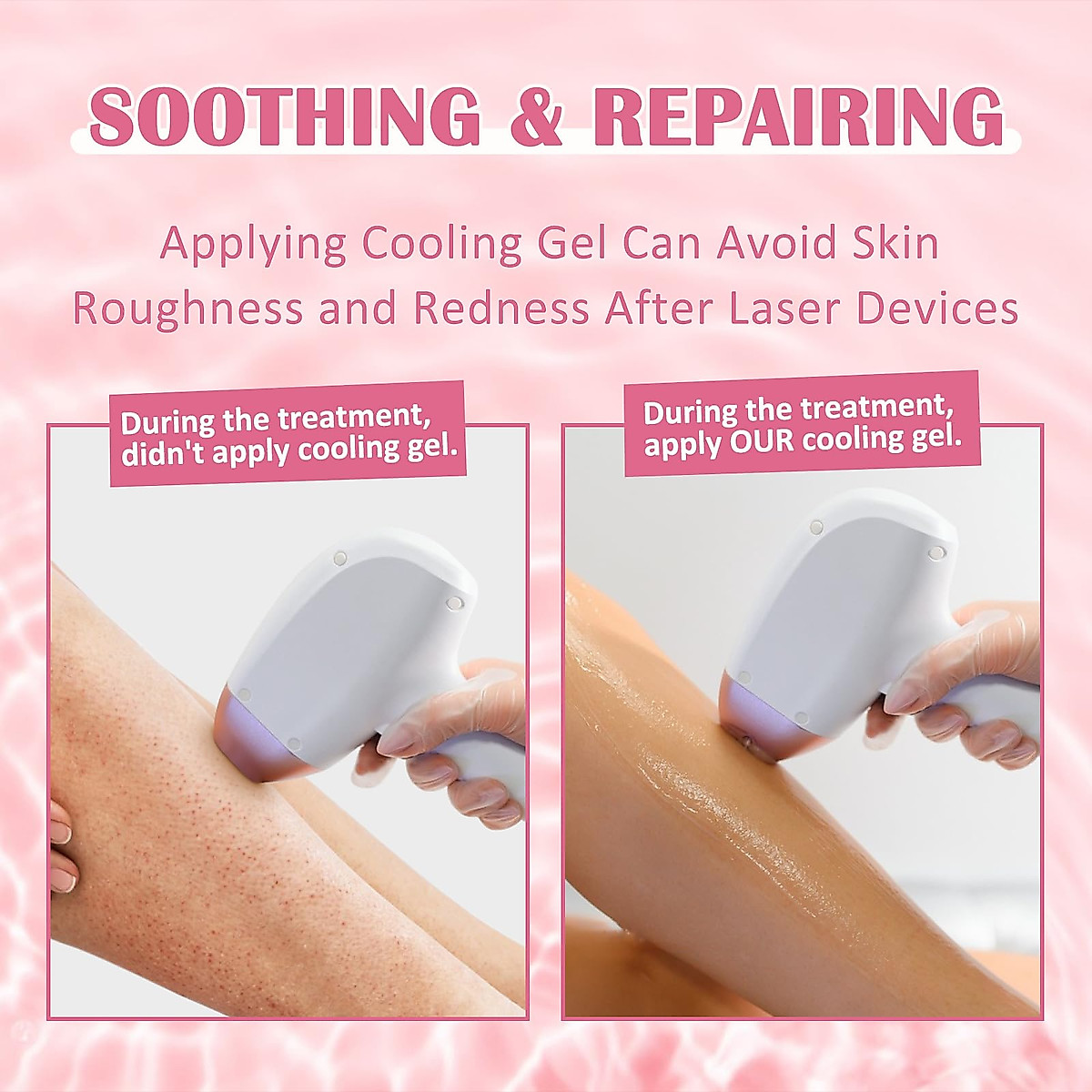 DUOVIO Coupling and Cooling Gel Use with IPL Hair Removal Device and Beauty Facial Machine for Women or Men in Face and Body 300ML