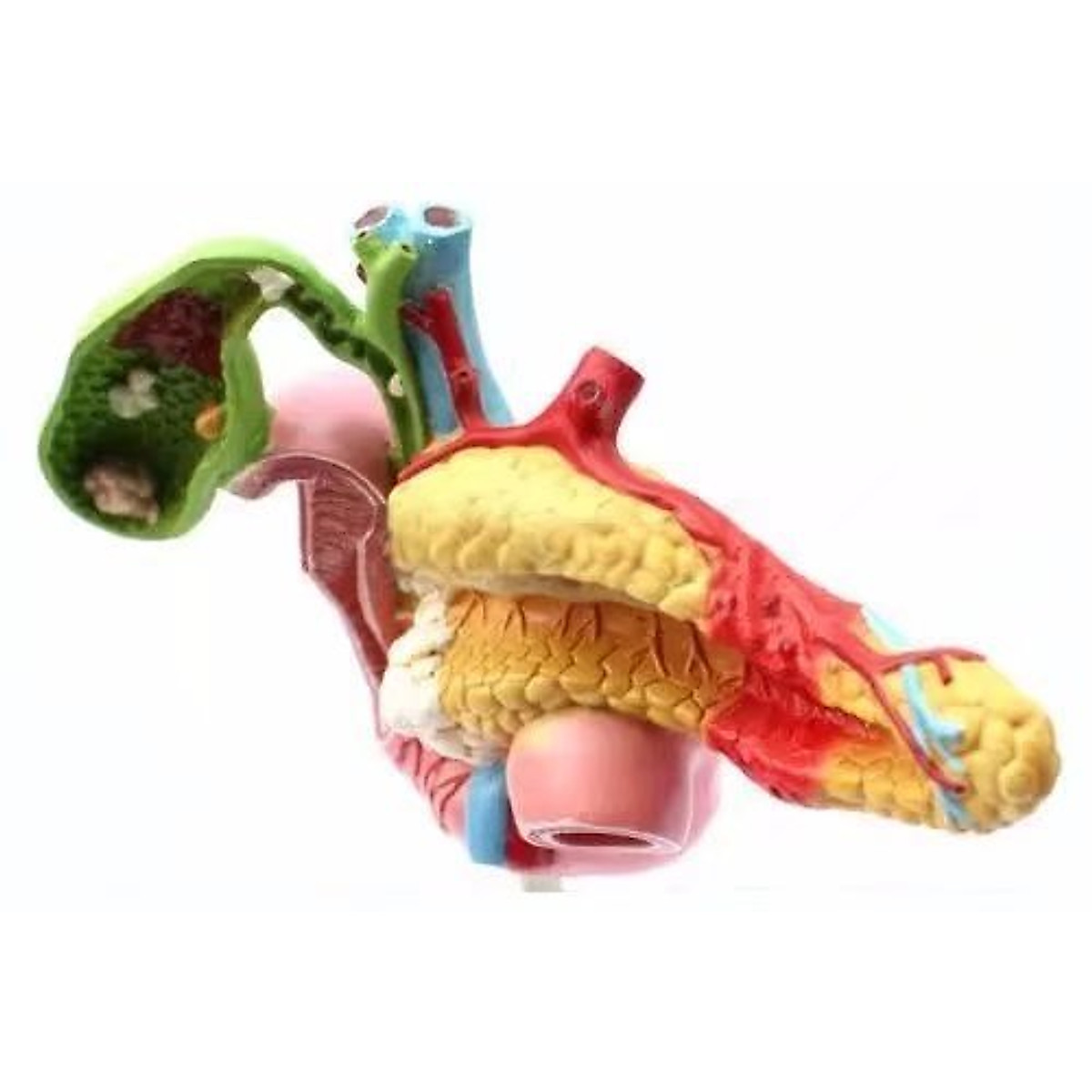BoNew Human Duodenum Gall Bladder Disease Anatomy Medical Model Life Size