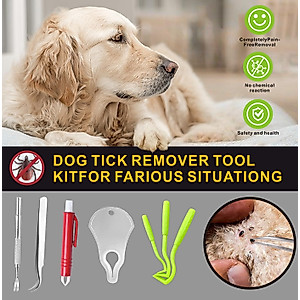 Mrcopetal Tick Remover Tool Kit, Stainless Steel Tick Tweezers + Remover Tick Key, 4 Pack Quick & Safe Tick Twister Removal Tools for Dogs Cats Humans